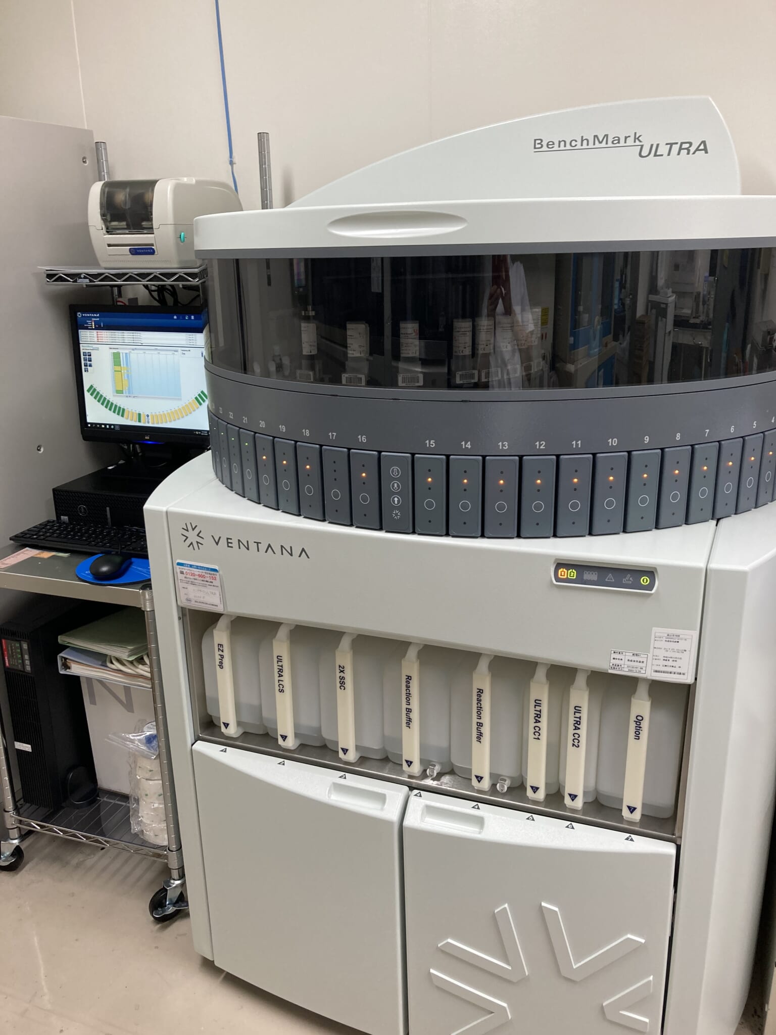BenchMark ULTRA | 兵庫県立加古川医療センター